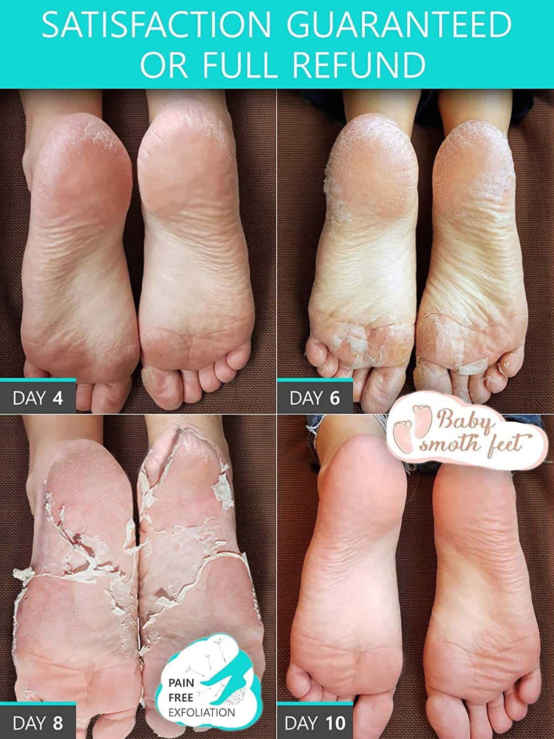 How do Foot Peels Work? (2025) : Curly Girly Says